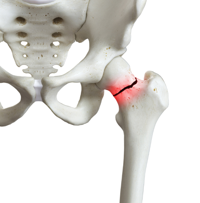 Dr. Nacef Jemai - Chirurgien spécialiste en chirurgie orthopédique et ...